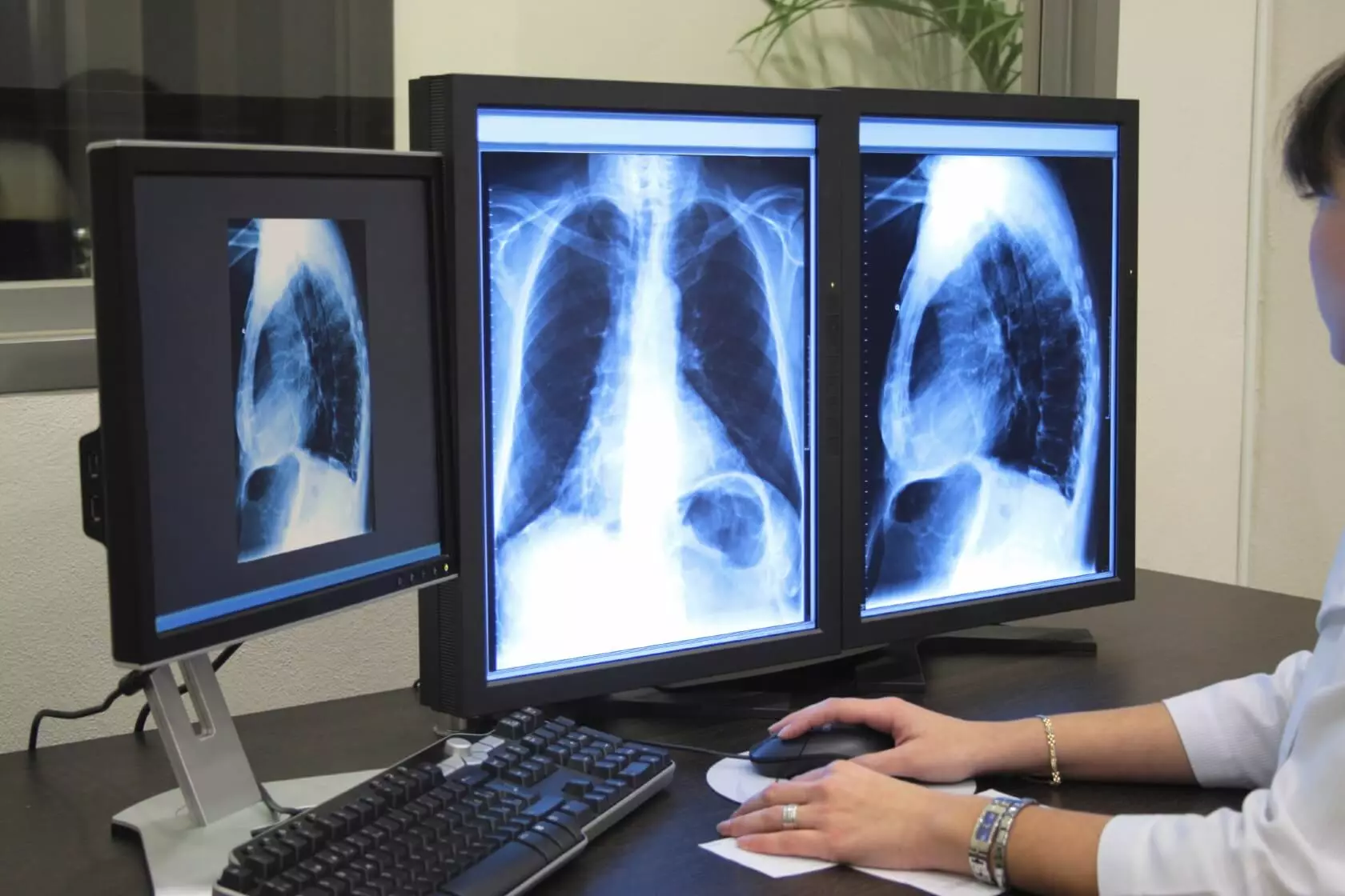 Nvidia colaborează cu Colegiul American de Radiologie pentru a oferi radiologilor instrumente gratuite de inteligență artificială 31116_2